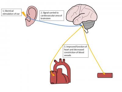 TENS Diagram [IMAGE] | EurekAlert! Science News Releases