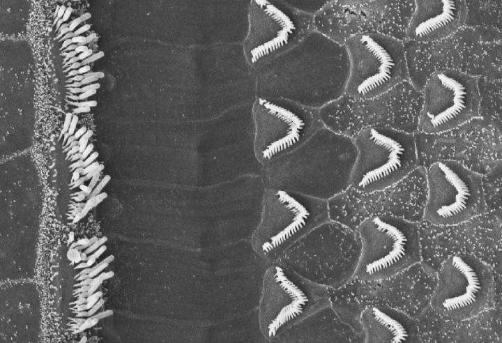 An inner ear protein speaks volumes about how | EurekAlert!