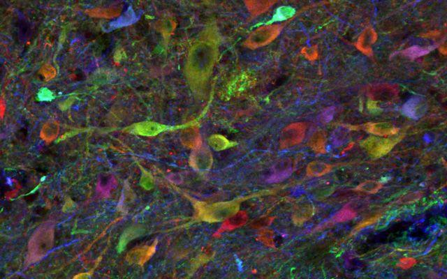 IPSCs Derived Neurons [IMAGE] | EurekAlert! Science News Releases