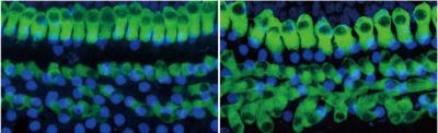 Cochlea After Damage Only and [IMAGE] | EurekAlert! Science News Releases