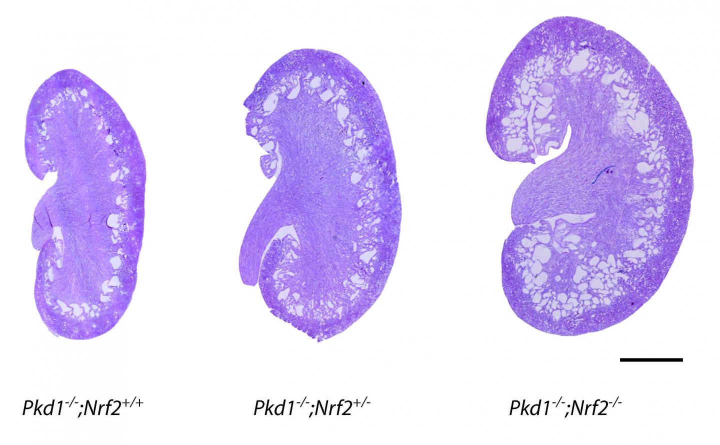 Therapies Restore Antioxidant [IMAGE] | EurekAlert! Science News Releases