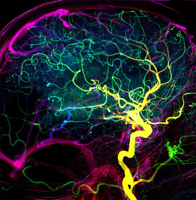Blood vessels in the brain (ea [IMAGE] | EurekAlert! Science News Releases