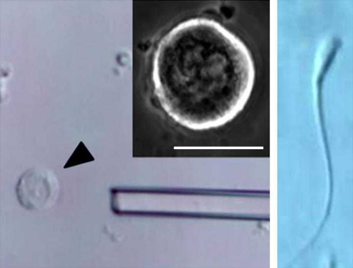 Boosting Sperm Production Through Two Differe | EurekAlert!