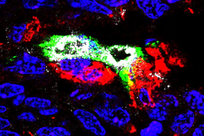 Macrophages [IMAGE] | EurekAlert! Science News Releases
