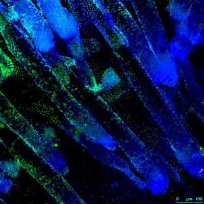 Skin Stem Cells [IMAGE] | EurekAlert! Science News Releases