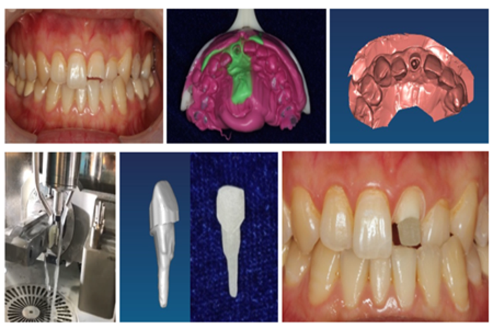 Device by PUHS research group receives approv | EurekAlert!