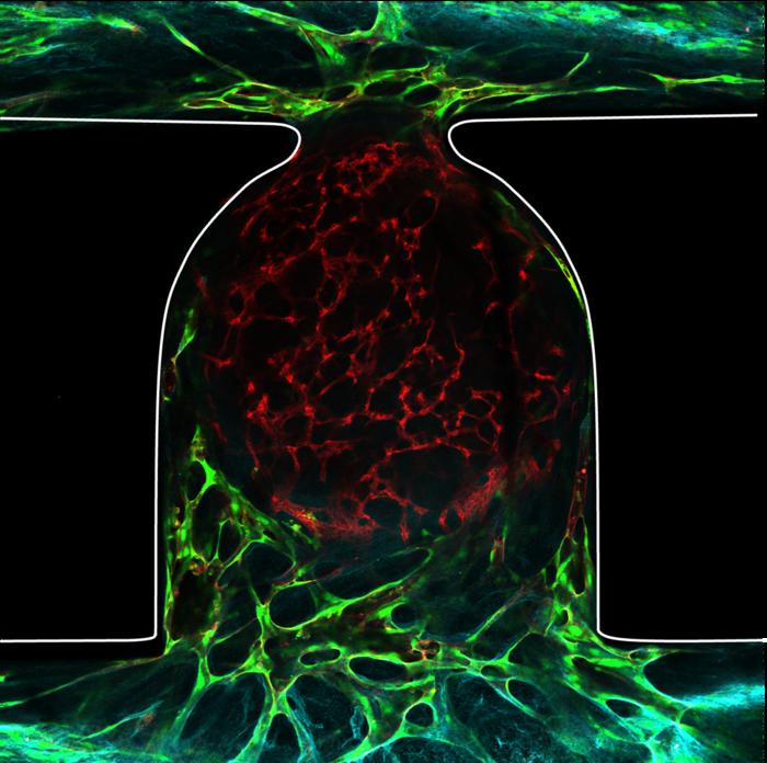 Vascular Tree [IMAGE] | EurekAlert! Science News Releases