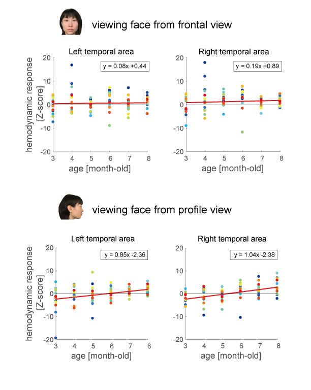 Hemodynamic Response [IMAGE] | EurekAlert! Science News Releases