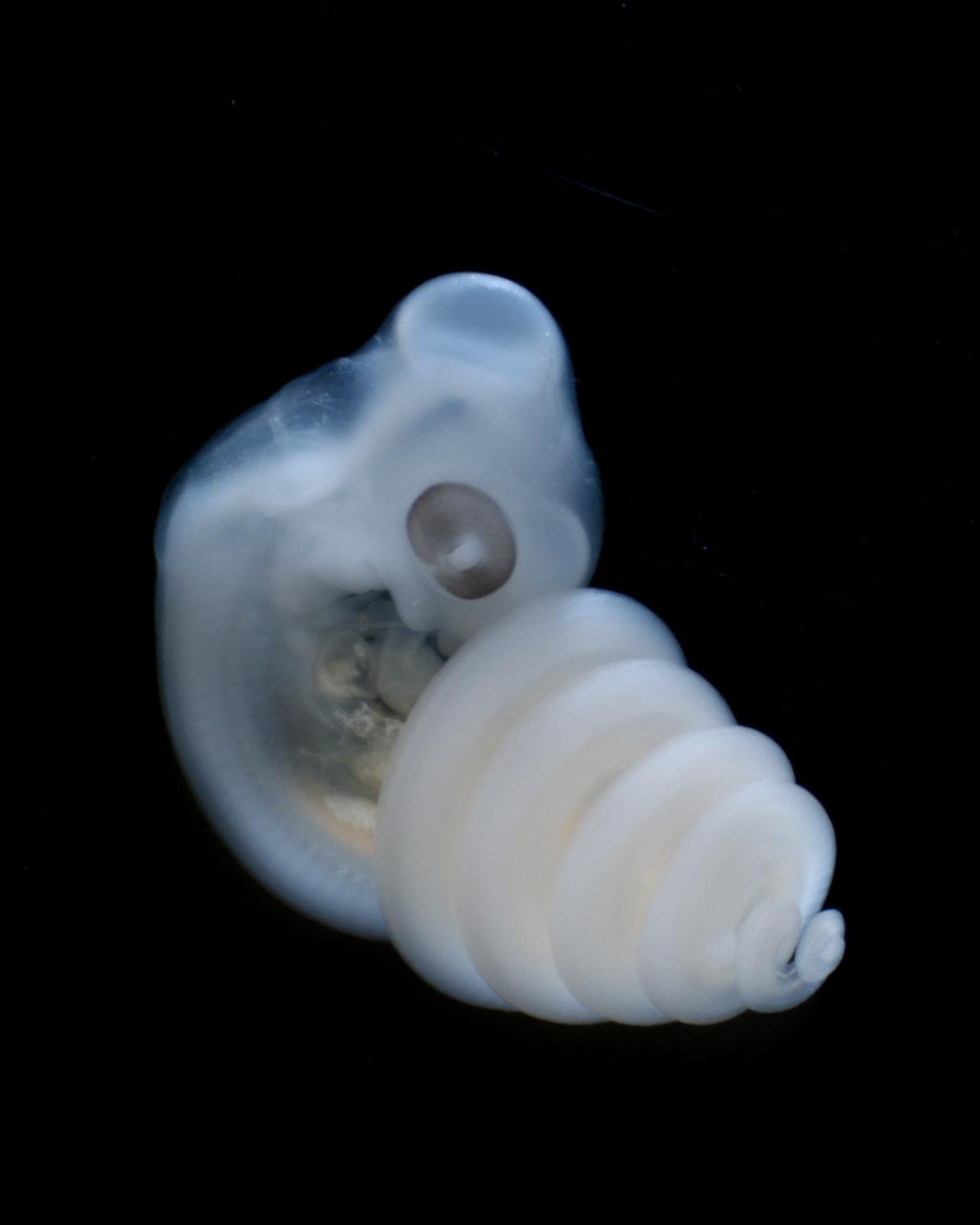 Genesis of genitalia | EurekAlert!