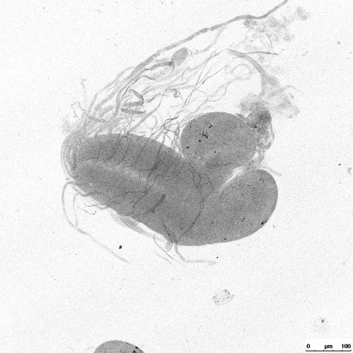 Inviable Hybrid Male Fruit Fly [IMAGE] | EurekAlert! Science News Releases