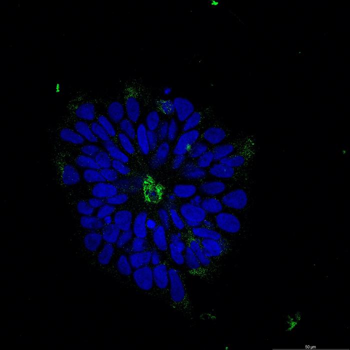 rosettes [IMAGE] | EurekAlert! Science News Releases