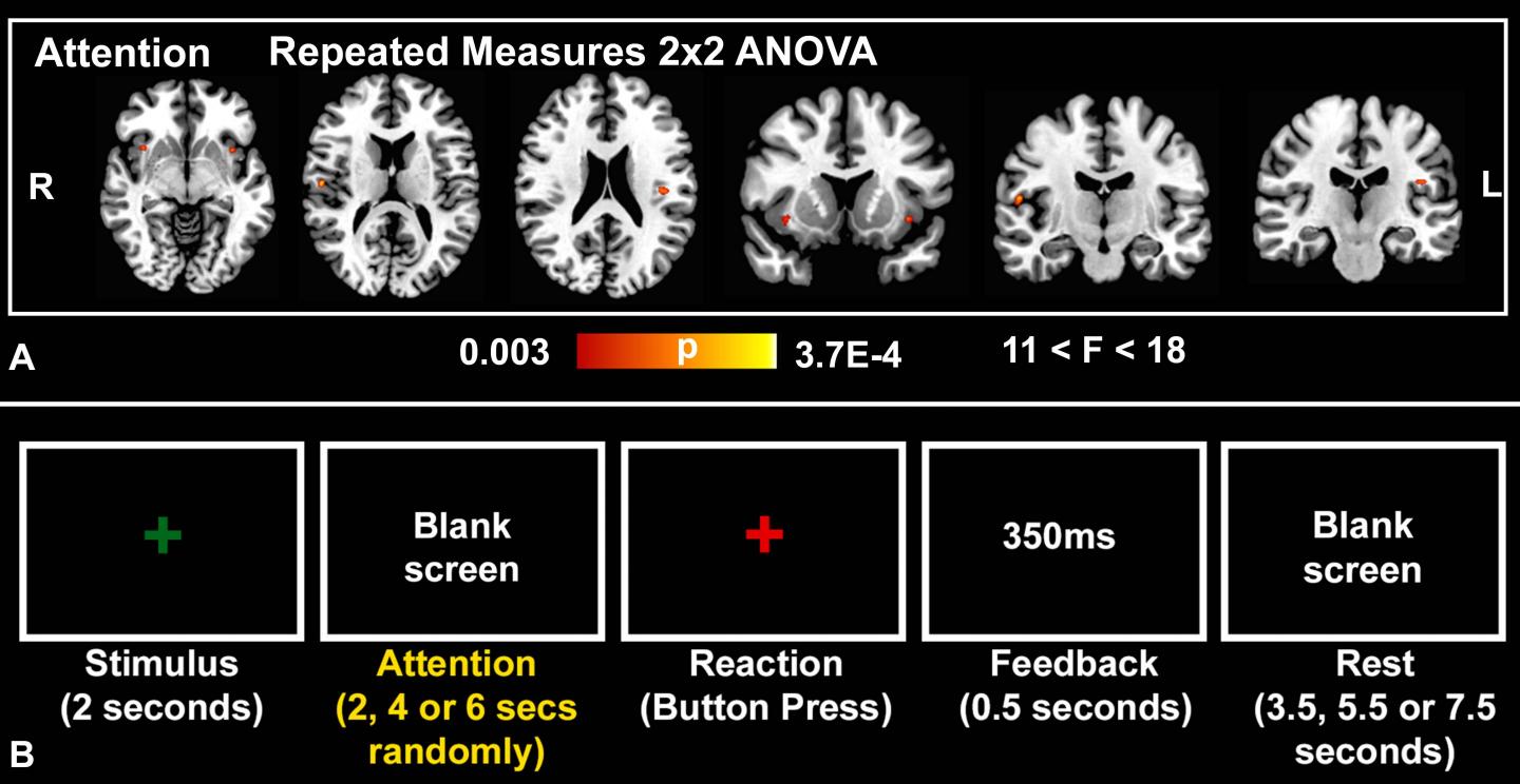 Figure 2: Psychomotor Vigilanc [IMAGE] | EurekAlert! Science News Releases