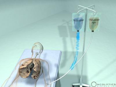 Combination of Chemo and Reoly [IMAGE] | EurekAlert! Science News Releases