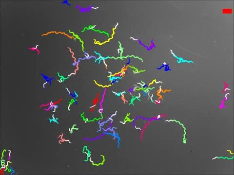 Wiggling Worms Offer Clues to Reperfusion Inj | EurekAlert!