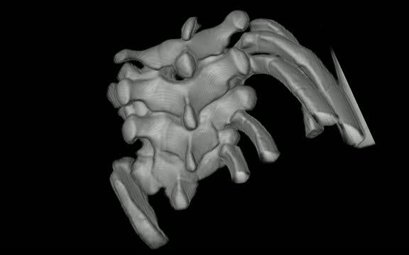 3.3-million-year-old fossil reveals origins o | EurekAlert!