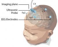 A Portable Bedside Brain Scanner for Babies ( | EurekAlert!