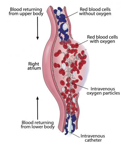 Injected Microparticles Deliver Life-Saving O | EurekAlert!