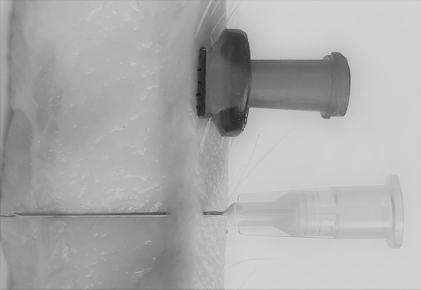 Microneedle versus hypodermic [IMAGE] | EurekAlert! Science News Releases