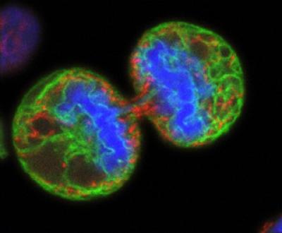 Human Cell [IMAGE] | EurekAlert! Science News Releases