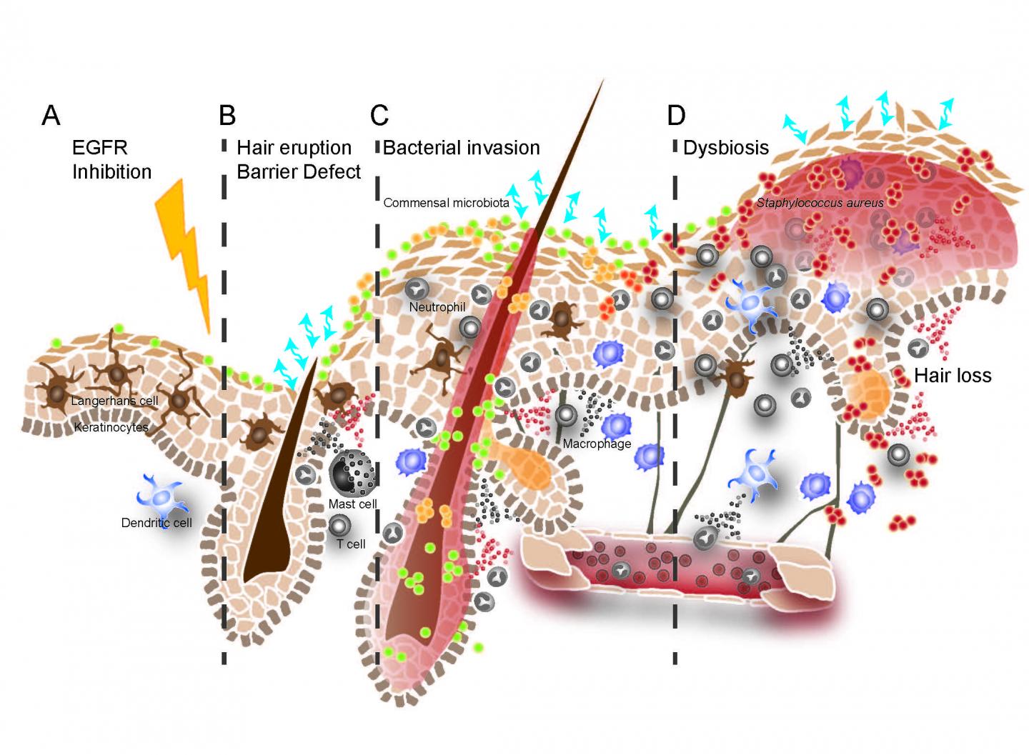 Rebellious Microbiota Contribute to Skin Dama | EurekAlert!