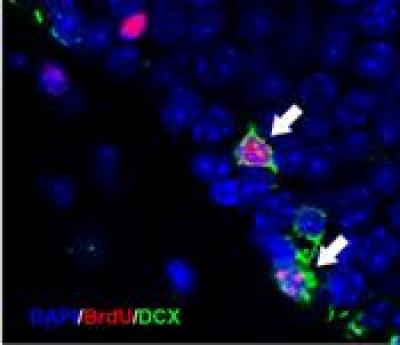 BrdU- and DCX-Positive Cells [IMAGE] | EurekAlert! Science News Releases