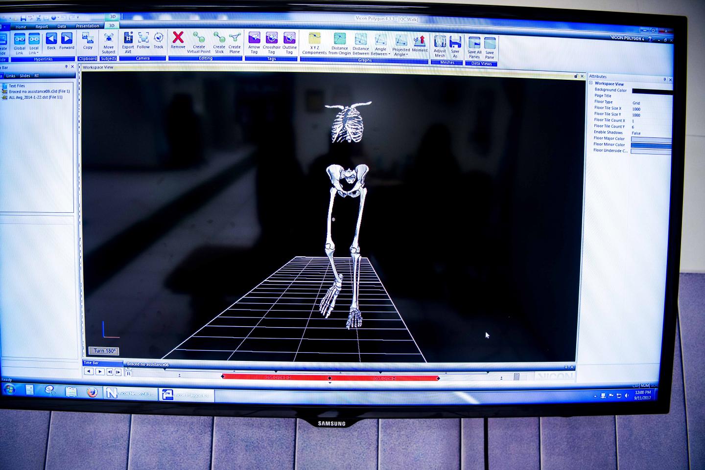 Motion Analysis at Children's [IMAGE] | EurekAlert! Science News Releases