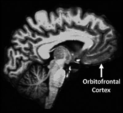 Personality/Brain Aging, Orbitofrontal Cortex | EurekAlert!