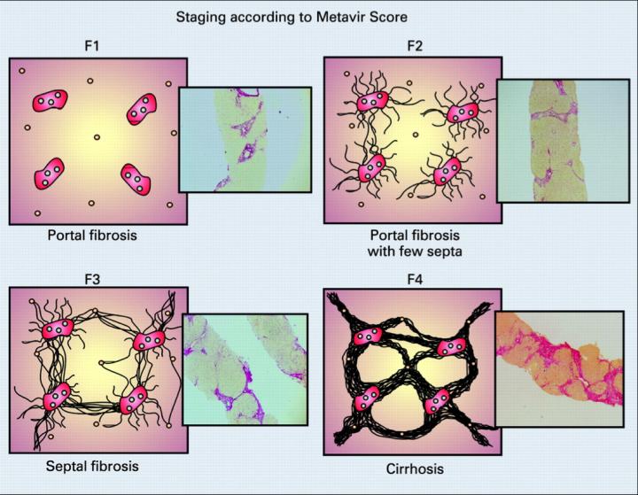 Penn researchers model the mechanics of cells | EurekAlert!