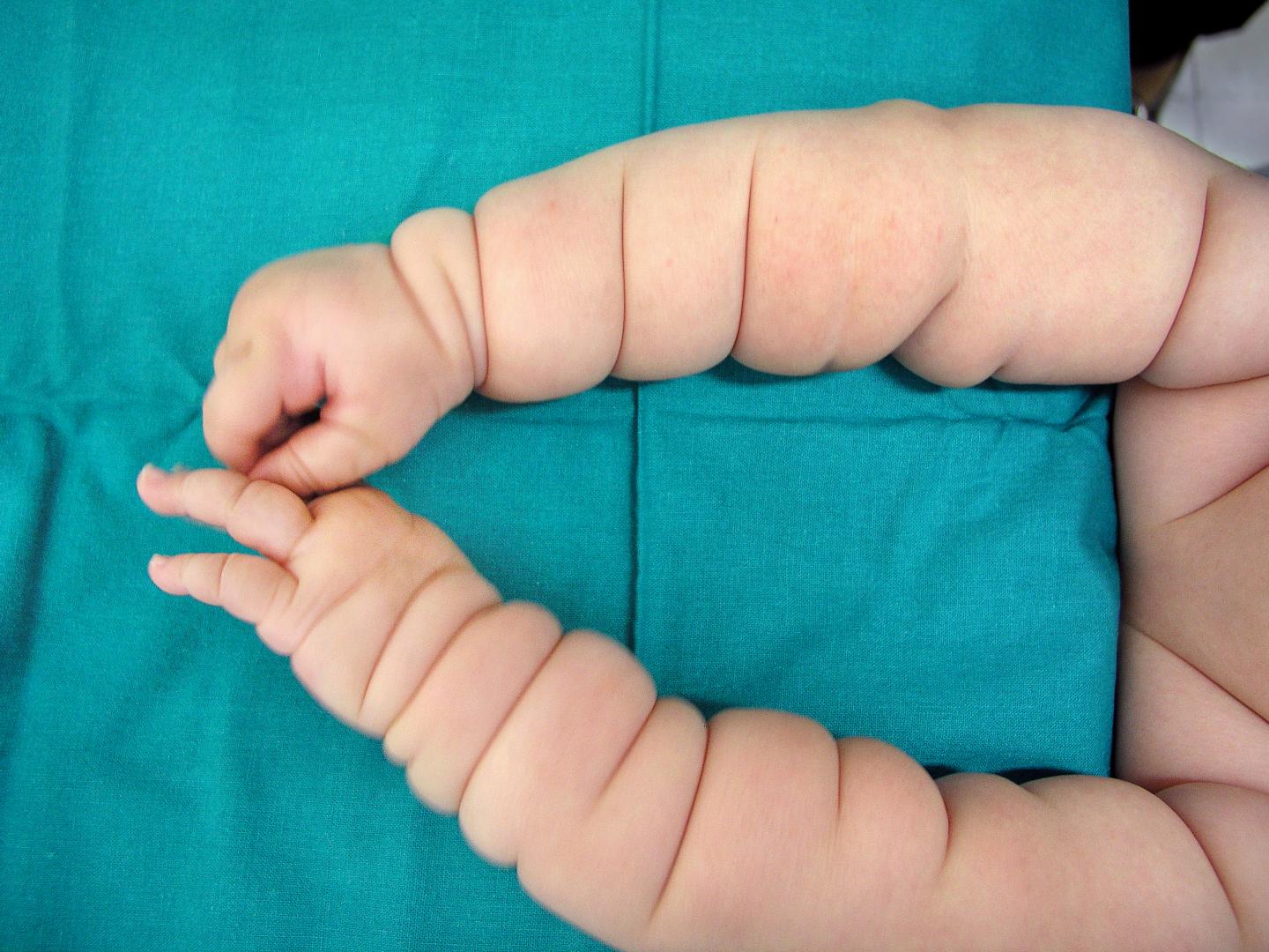 Two Genes Linked To Intellectu [IMAGE] | EurekAlert! Science News Releases