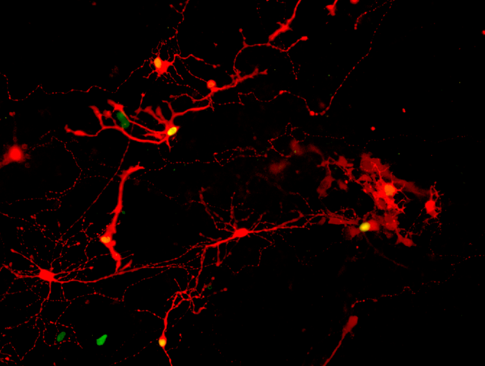 retinal_neurons [IMAGE] | EurekAlert! Science News Releases