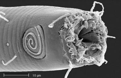 Marine Nematode [IMAGE] | EurekAlert! Science News Releases