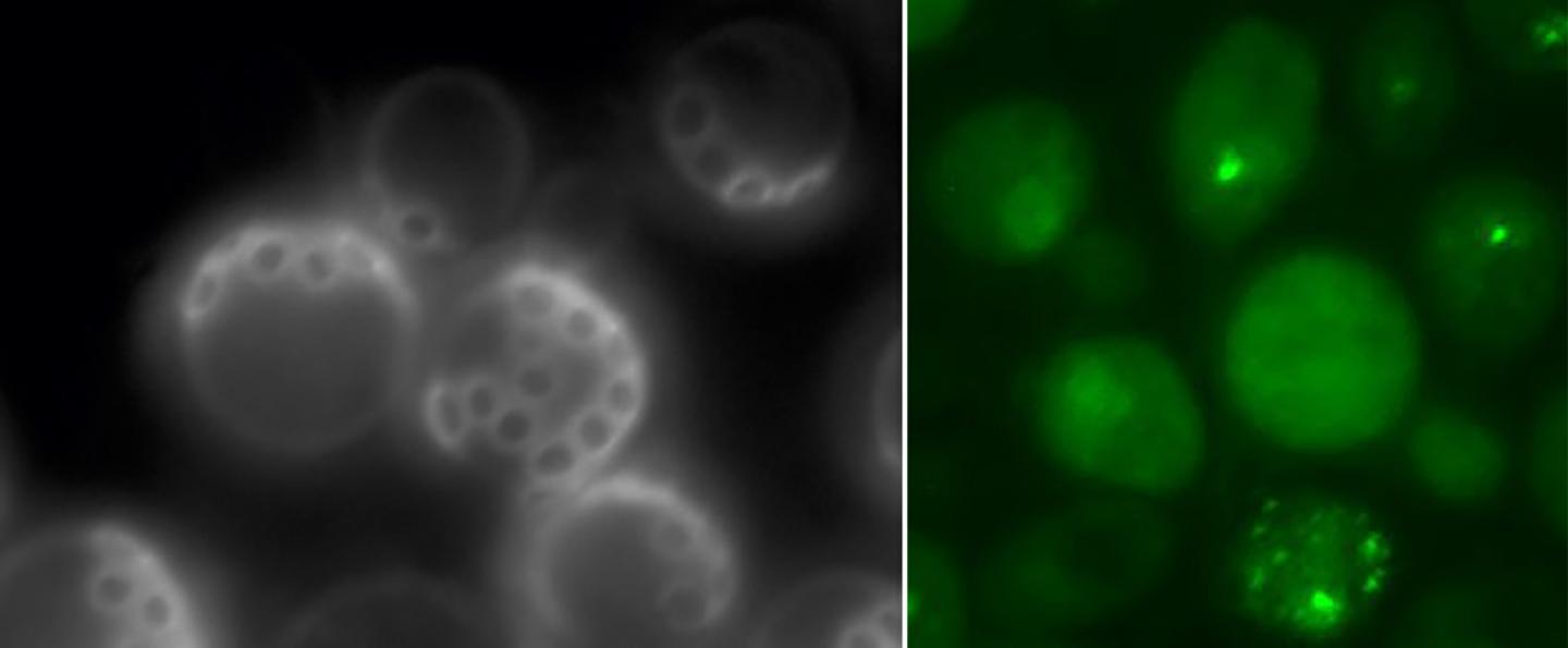 Yeast Cells Seen In Microscope [IMAGE] | EurekAlert! Science News Releases
