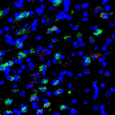 Neurons in NTS [IMAGE] | EurekAlert! Science News Releases