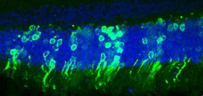 Integrated Photoreceptor Cells [IMAGE] | EurekAlert! Science News Releases