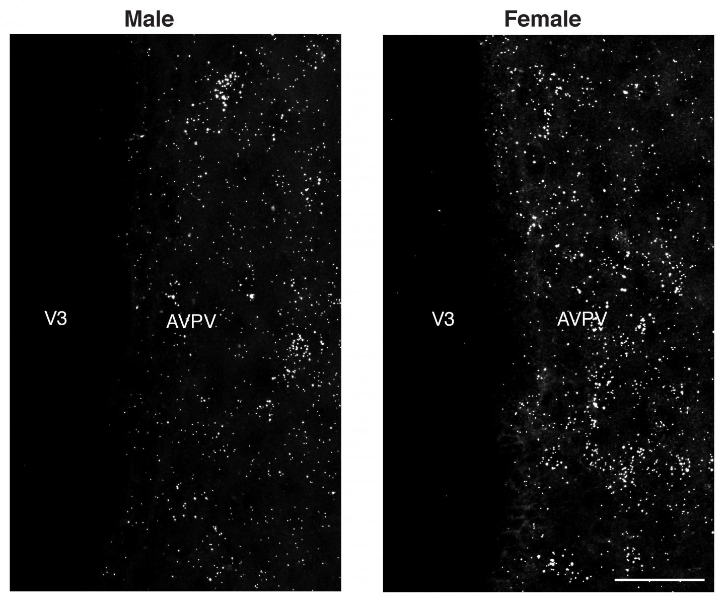 A Receptor That Controls Appet [IMAGE] | EurekAlert! Science News Releases