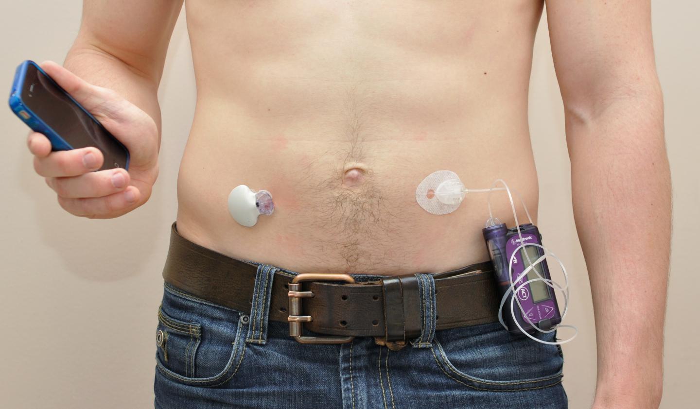 Artificial Pancreas [IMAGE] | EurekAlert! Science News Releases