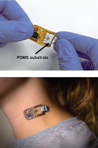 Wireless Skin Sensors Detect Shunt Malfunctio | EurekAlert!