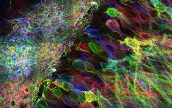 Edward Boyden, Massachusetts I [IMAGE] | EurekAlert! Science News Releases