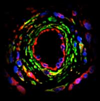 Nogo Protein 'A Go' in Lung Disease | EurekAlert!