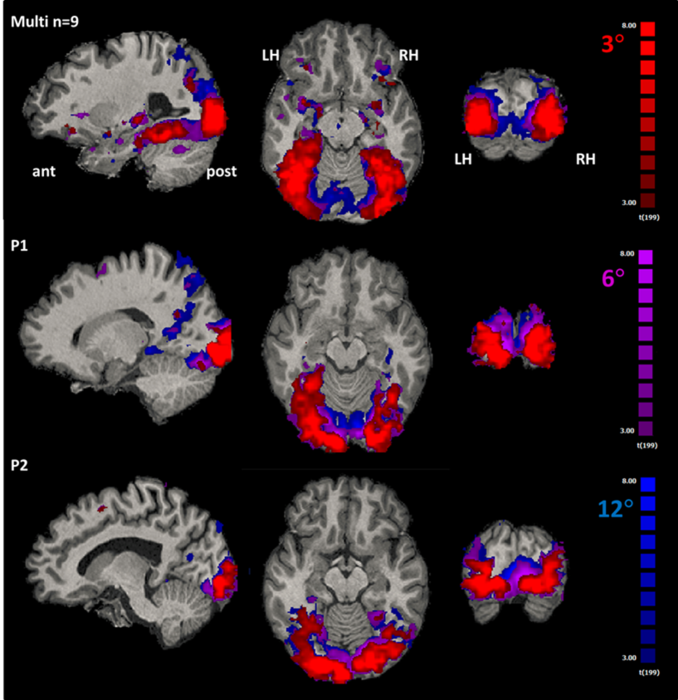In visual memory, size matters [IMAGE] | EurekAlert! Science News Releases
