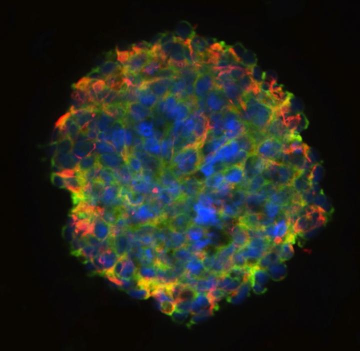 Human Neural Stem Cells [IMAGE] | EurekAlert! Science News Releases