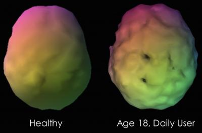 New Study Shows Marijuana User [IMAGE] | EurekAlert! Science News Releases