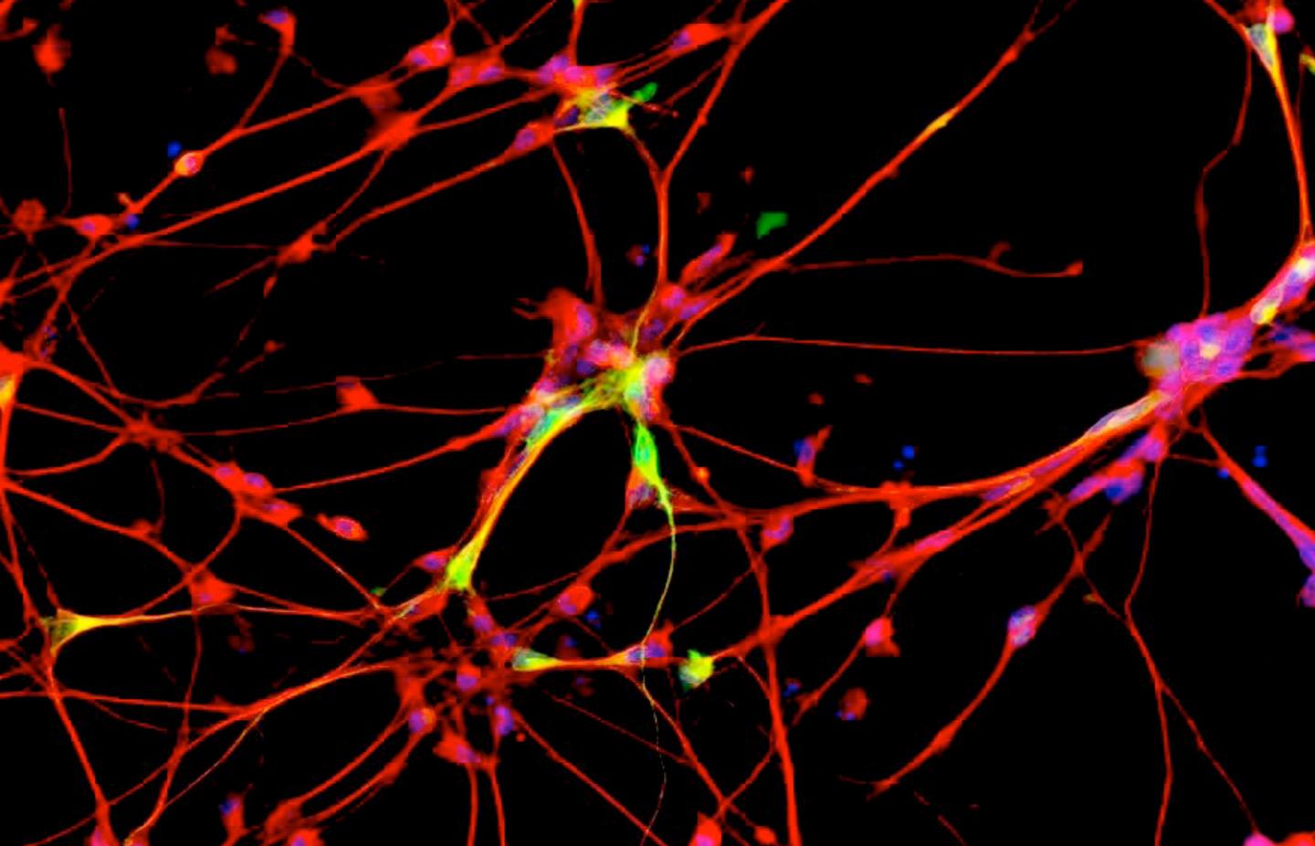 Dopamine-Producing Brain Cells [IMAGE] | EurekAlert! Science News Releases