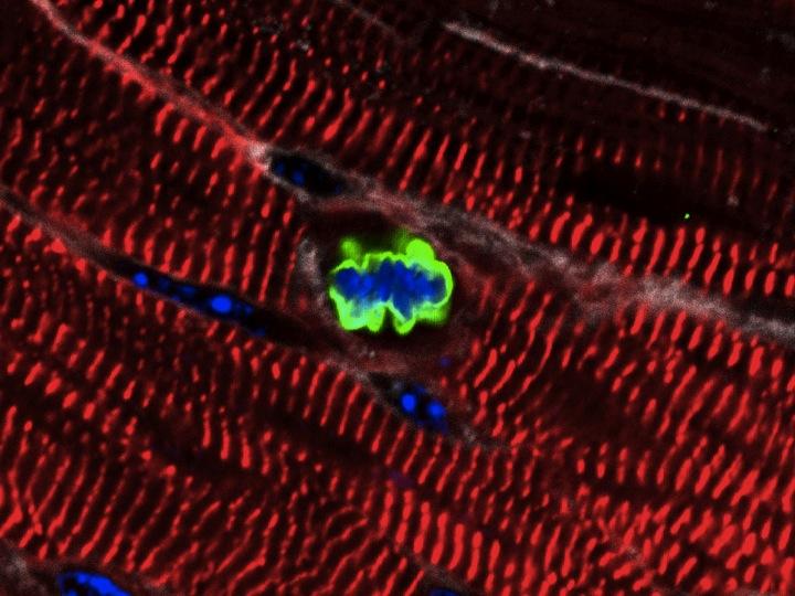Adult Cardiomyocyte [IMAGE] | EurekAlert! Science News Releases