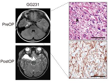 Figure Preoperative and Postop [IMAGE] | EurekAlert! Science News Releases