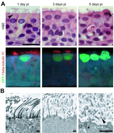 PIV NS2 Infection [IMAGE] | EurekAlert! Science News Releases
