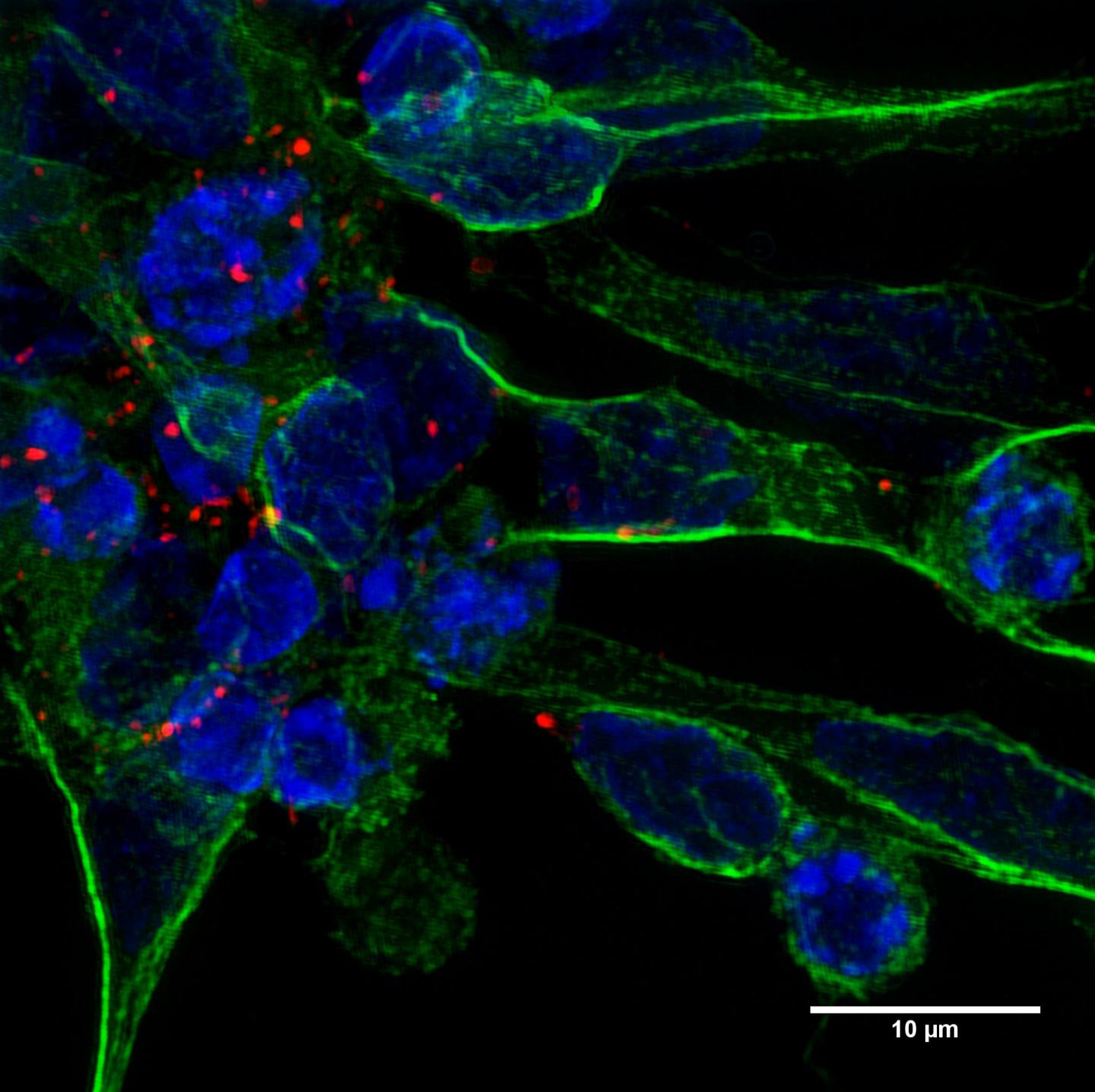 Exosome [IMAGE] | EurekAlert! Science News Releases