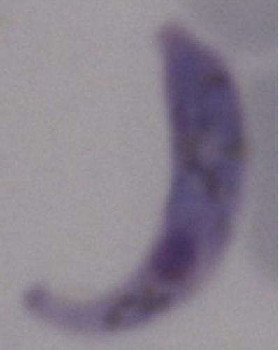 Mutant Malaria Parasite [IMAGE] | EurekAlert! Science News Releases