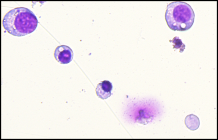 Differentiation of an Erythroi [IMAGE] | EurekAlert! Science News Releases