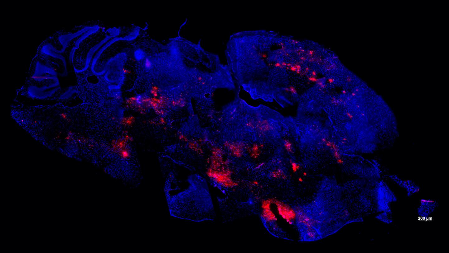Mouse Brain Infected by Virus [IMAGE] | EurekAlert! Science News Releases
